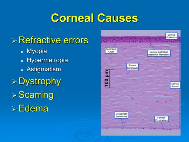 Chronic visual loss | PPTX