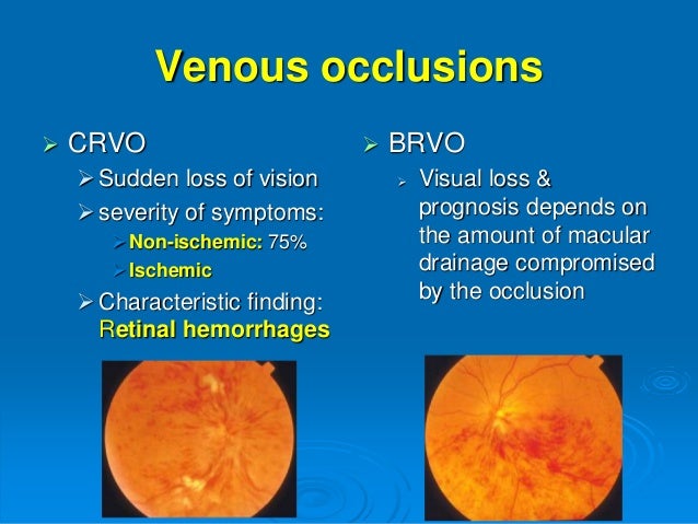 Chronic visual loss