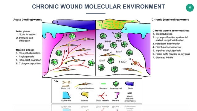 Chronic Wound Management Strategy | PPT