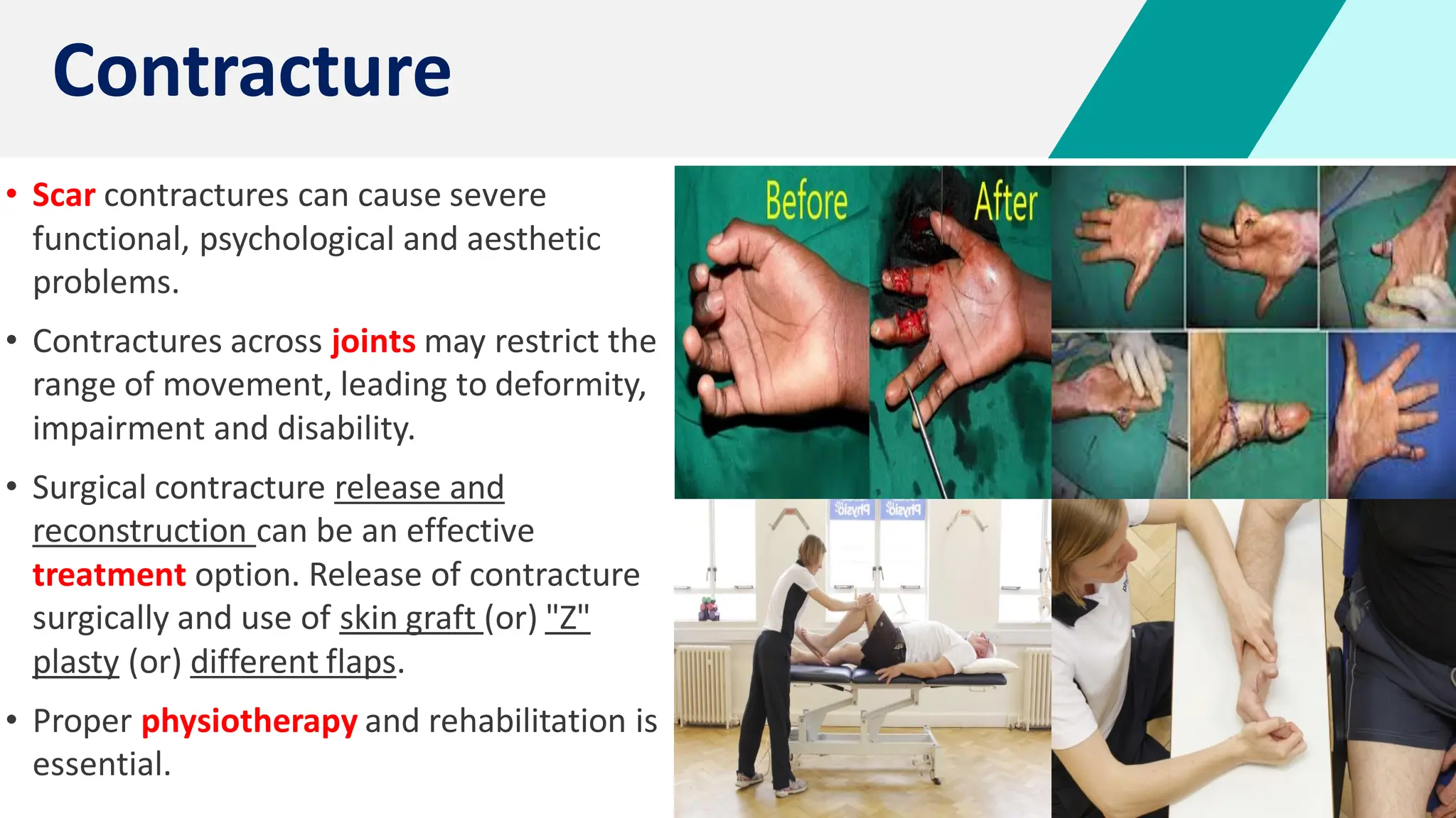 Chronic Wounds | PDF