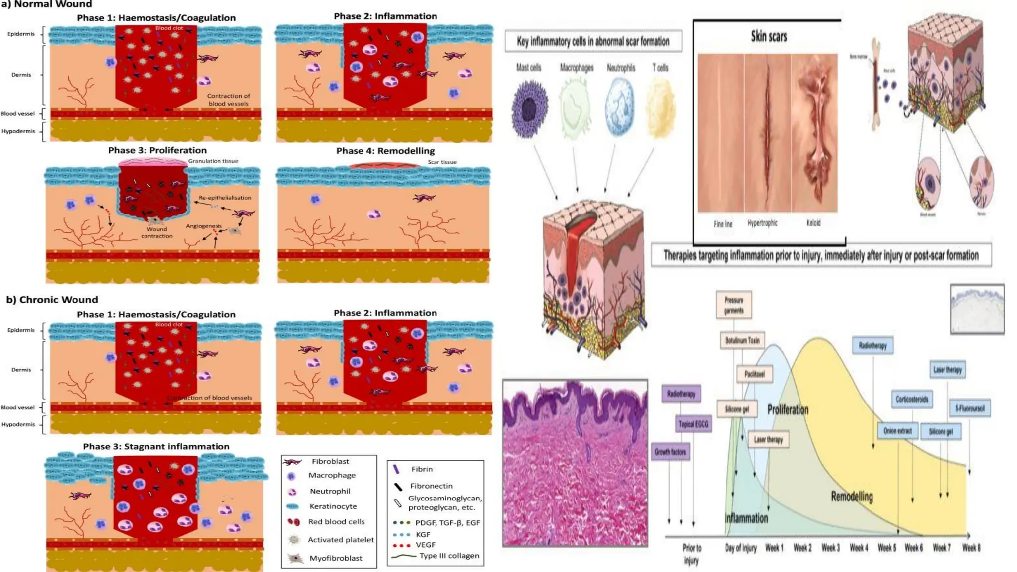 Chronic Wounds | PDF