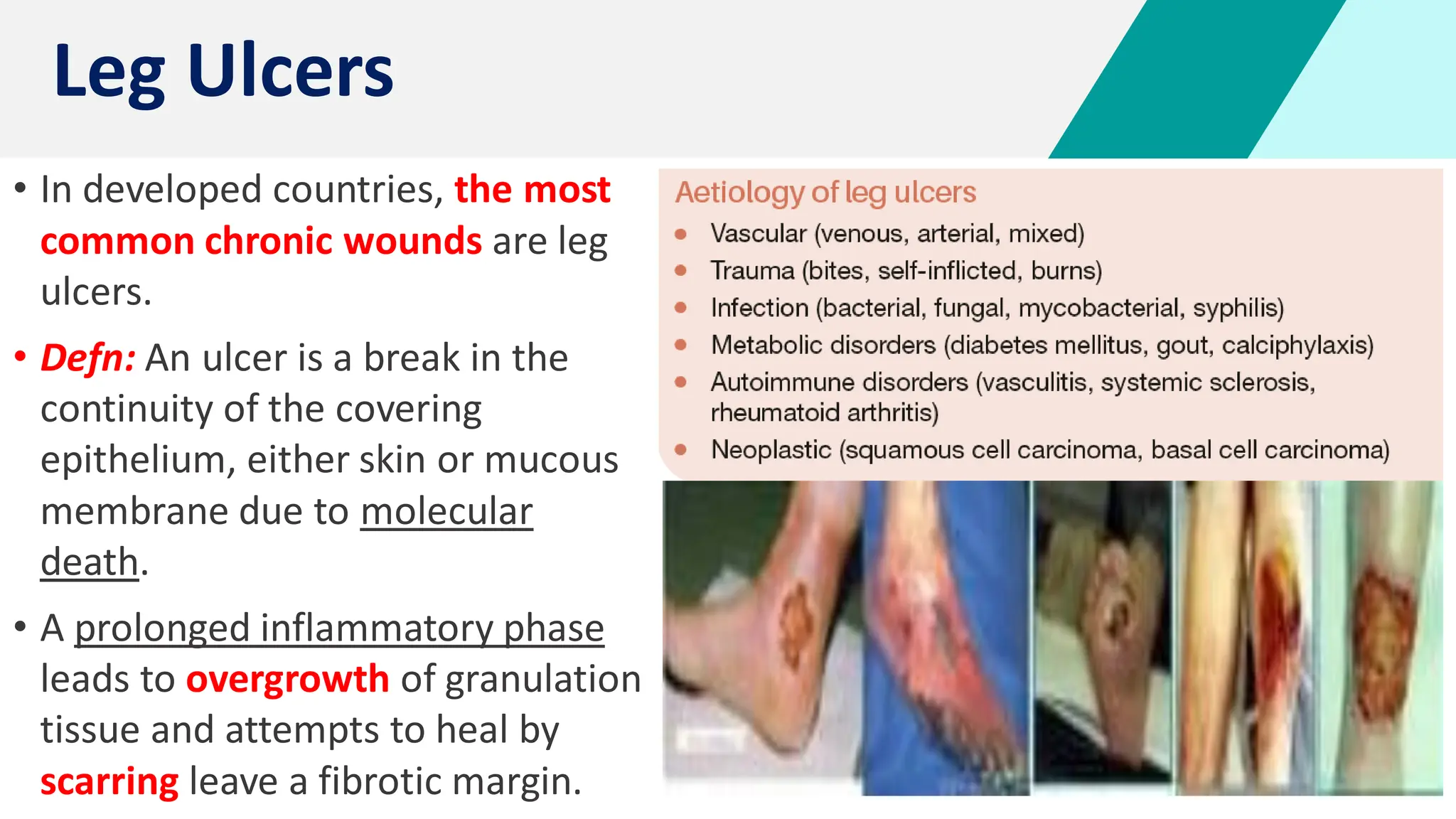 Chronic Wounds | PDF