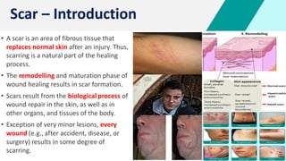 Chronic Wounds | PDF