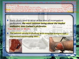 Chronic Wounds and types with managmentf | PDF