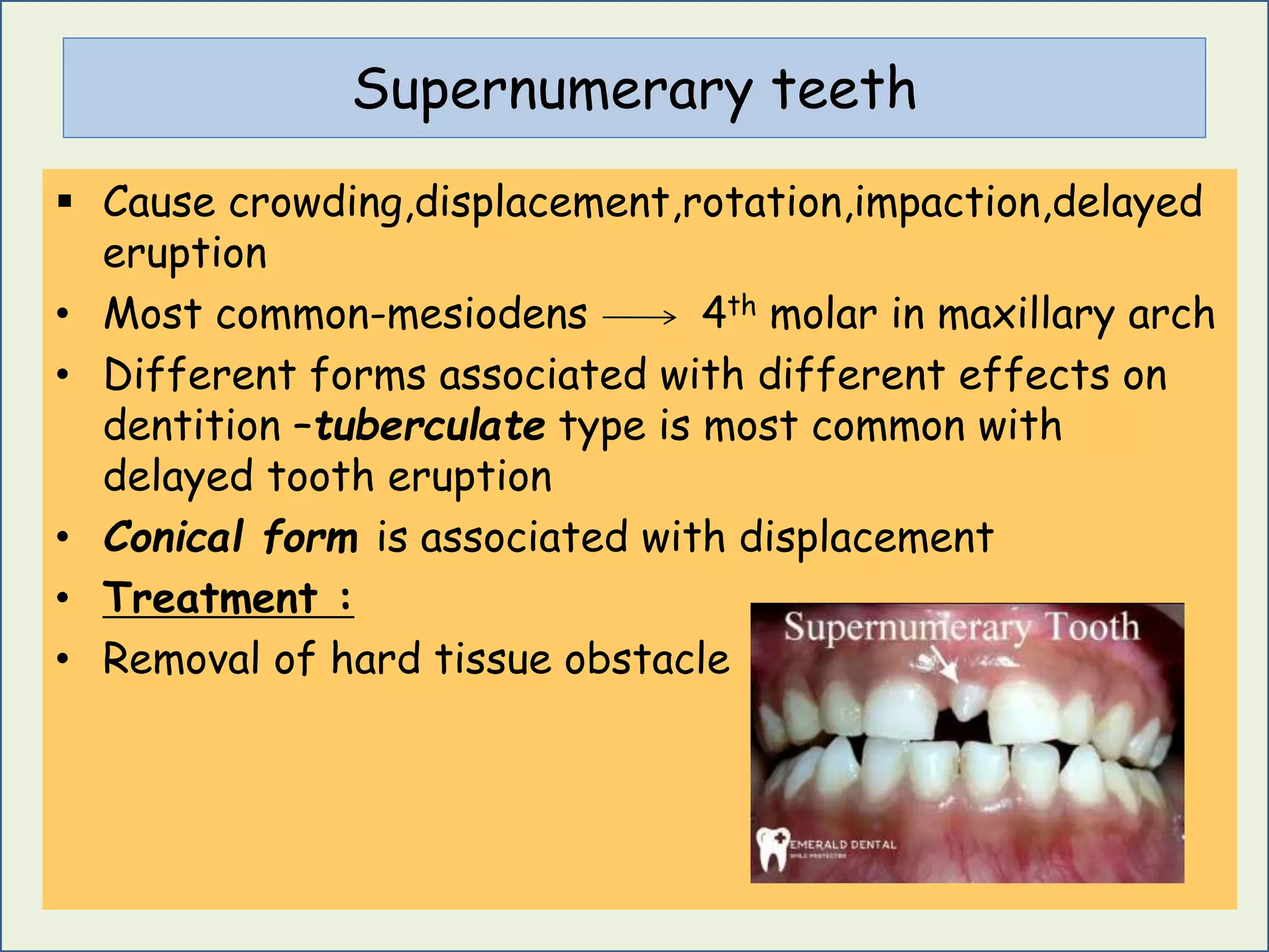 Chronology, Eruption disorders, importance of first permanent molar ...
