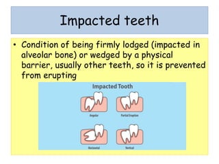 Chronology, Eruption disorders, importance of first permanent molar.pptx