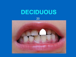 Chronology of crown formation | PPTX