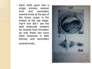 Chronology of dental development and development of occlusion | PPTX
