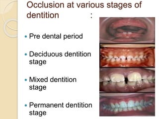 Chronology of dental development and development of occlusion | PPTX