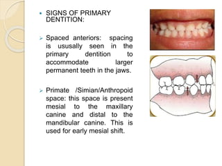 Chronology of dental development and development of occlusion | PPTX
