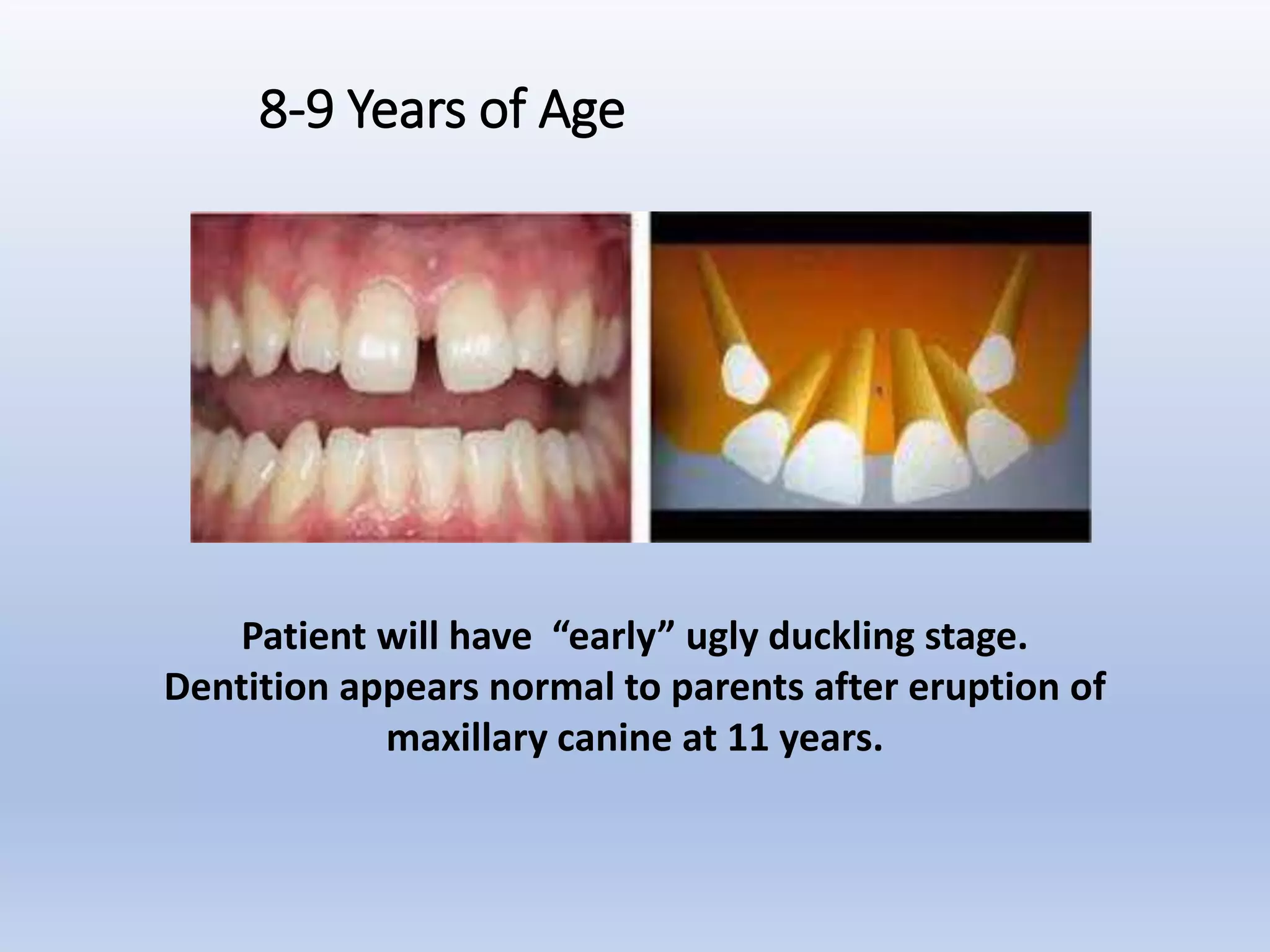 Chronology of Primary and Permanent Teeth-D. Saba Arshad.pptx