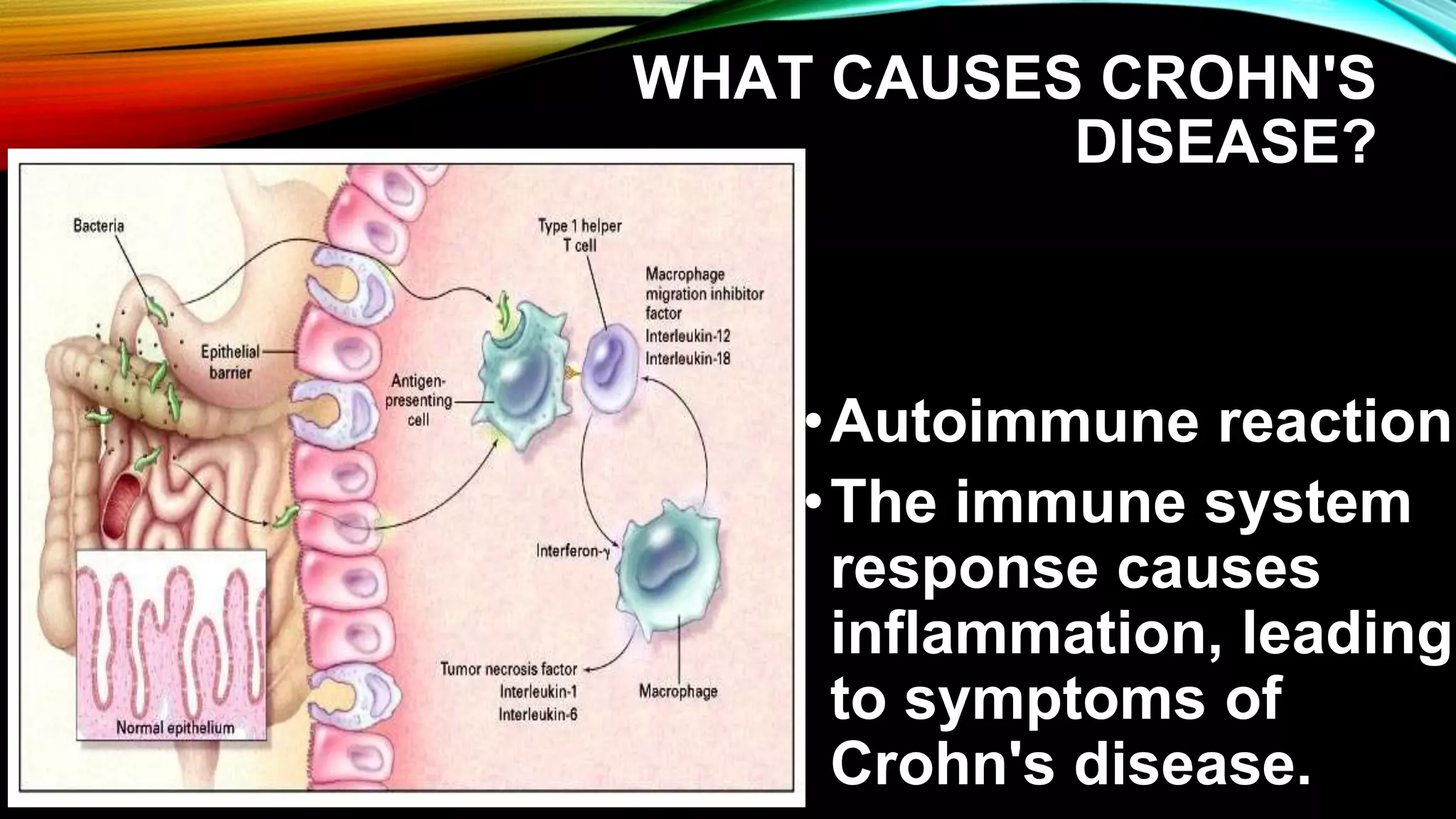 Chrons Diseasepptx