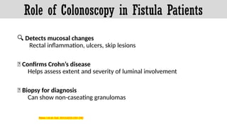 CHRONS FISTULA (COMPLEX FISTULA IN ANO) BY DR SAMRAT JANKAR | PPTX