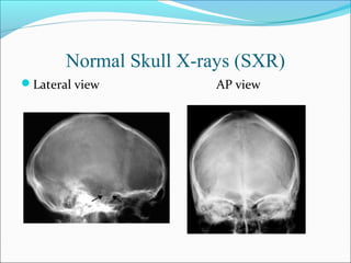 Chs 3111 cns pathology radiology | PPT