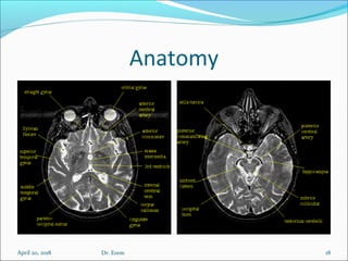 Chs 3111 cns pathology radiology | PPT