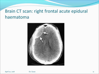 Chs 3111 cns pathology radiology | PPT