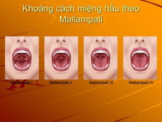 CHUẨN BỊ BỆNH NHÂN TRƯỚC MỔ | PDF