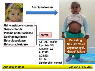 CITRIN DEFICIENCY | PPTX | Endocrine and Metabolic Diseases | Diseases ...