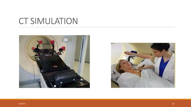 a brief overview about management of ca breast.pptx