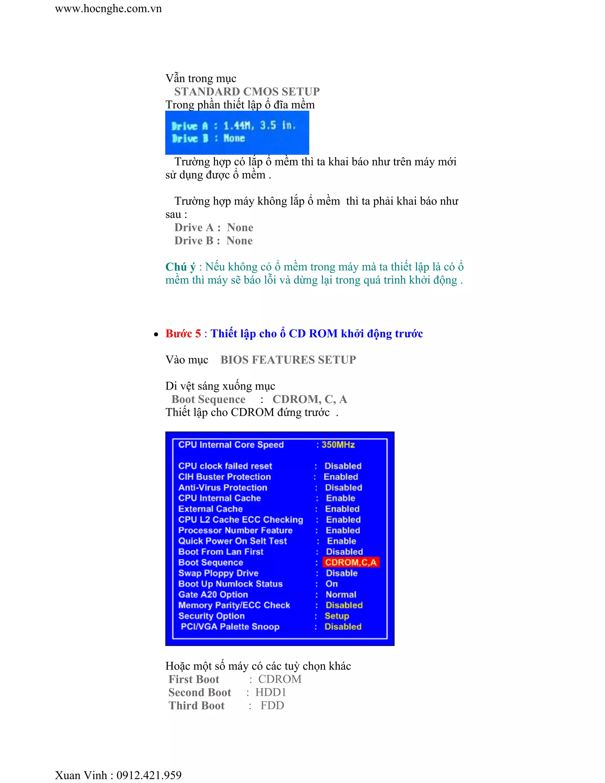 Chuong 10 laprap-mt | PDF