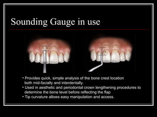 Chu’s Aesthetic Gauges from Hu-Friedy | PPT