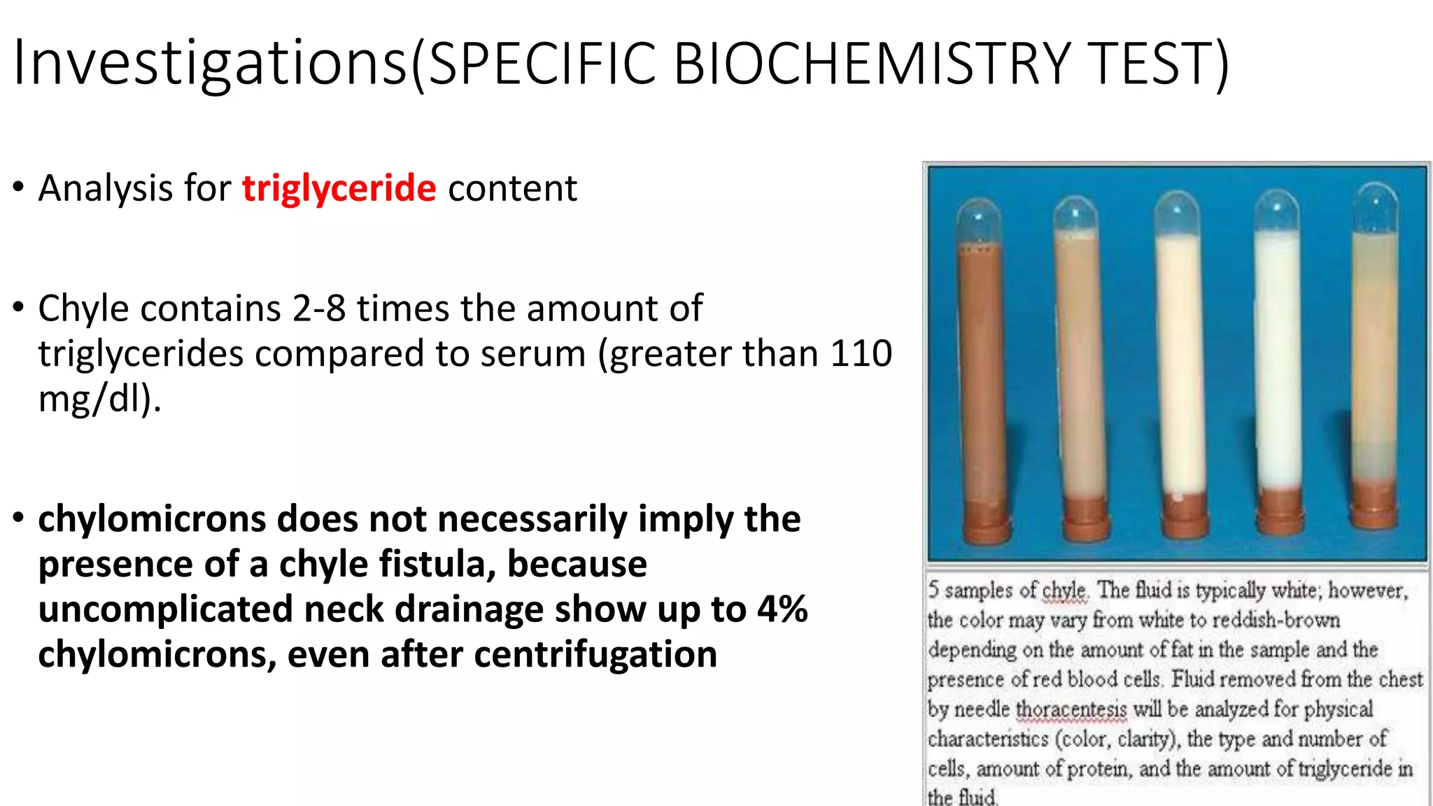 Chyle leakage | PPTX