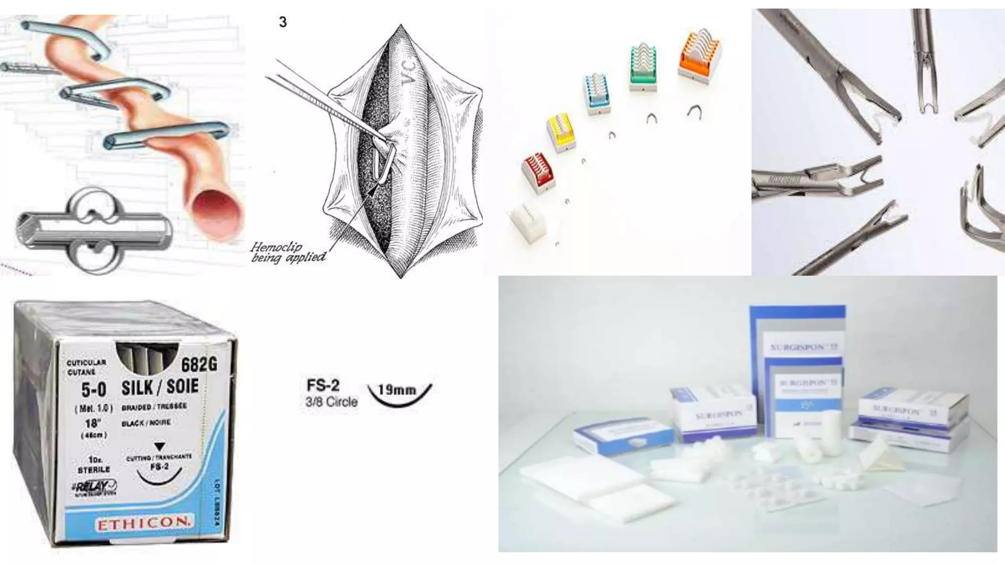 Chyle leakage | PPTX