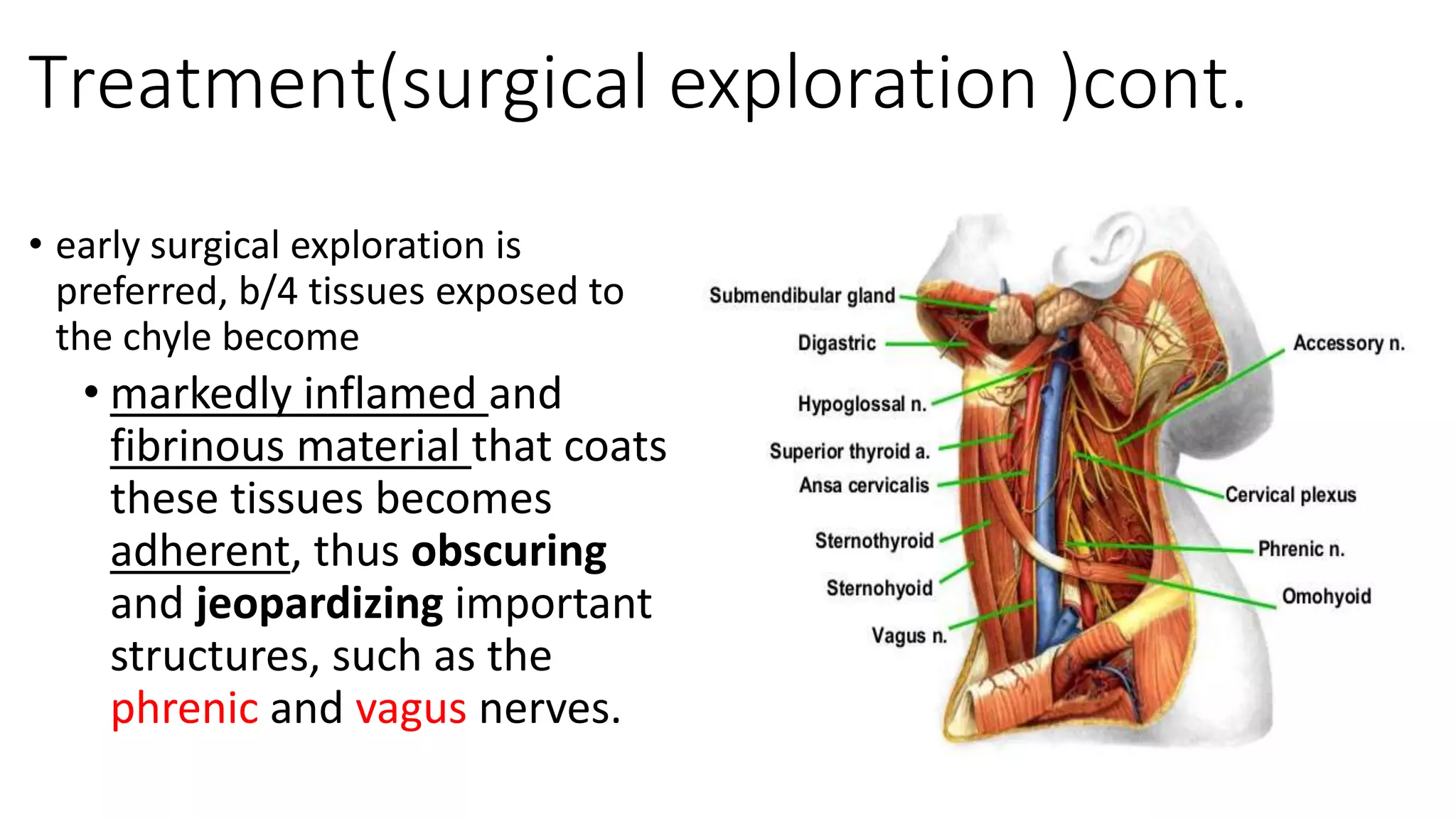 Chyle leakage | PPTX
