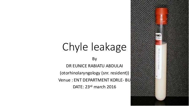 Chyle leakage