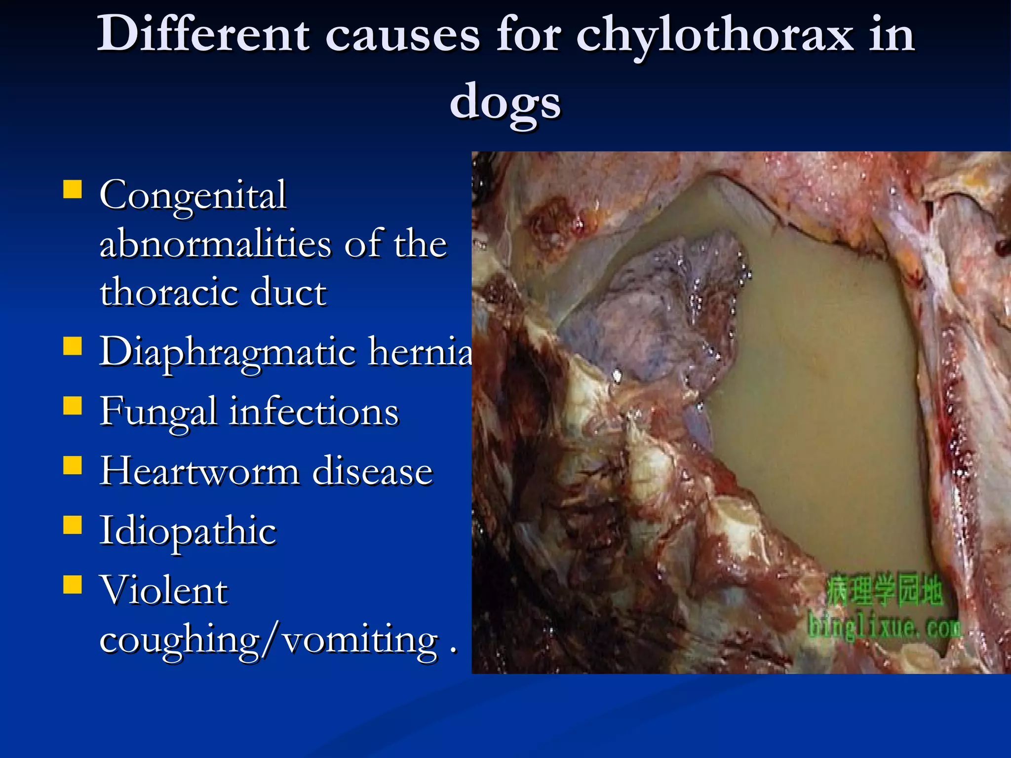 Chylothorax | PPT