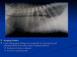 Chylothorax | PPT