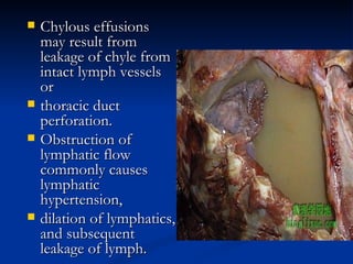 Chylothorax | PPT