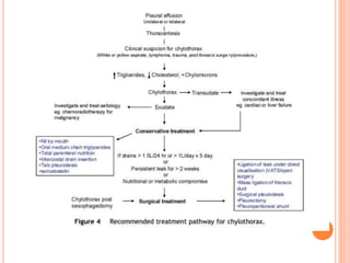 Chylothorax | PPTX