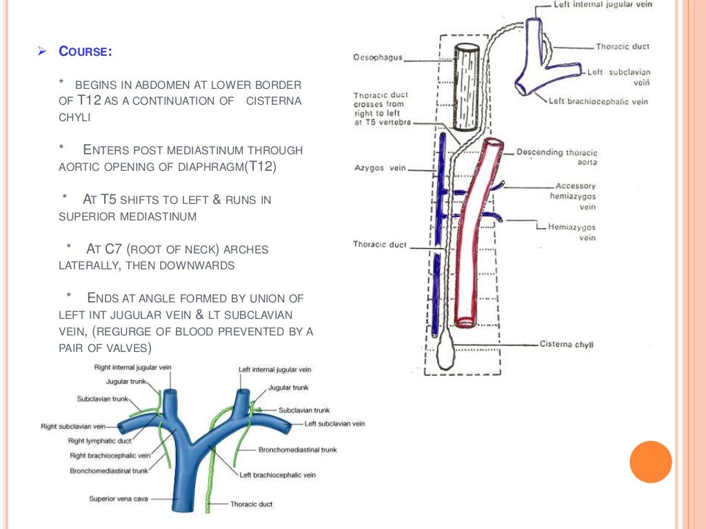 Chylothorax