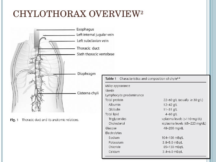 Chylothorax Case Study