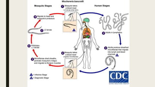 A ppt on chyluria diagnosis and management .pptx