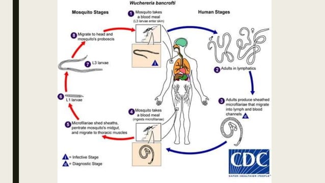 A ppt on chyluria diagnosis and management .pptx