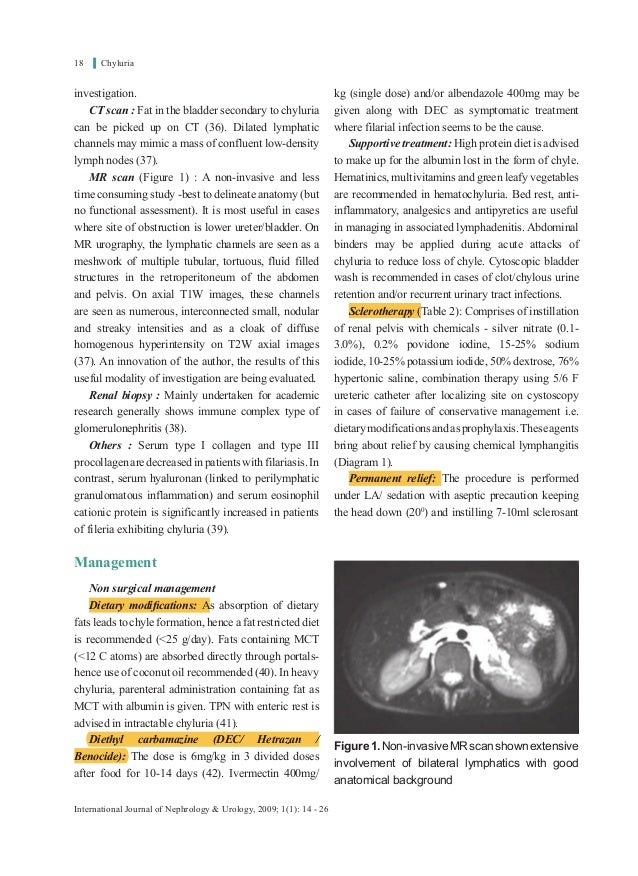 Chyluria -an_overview