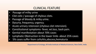 Chyluria presentation final | PPTX