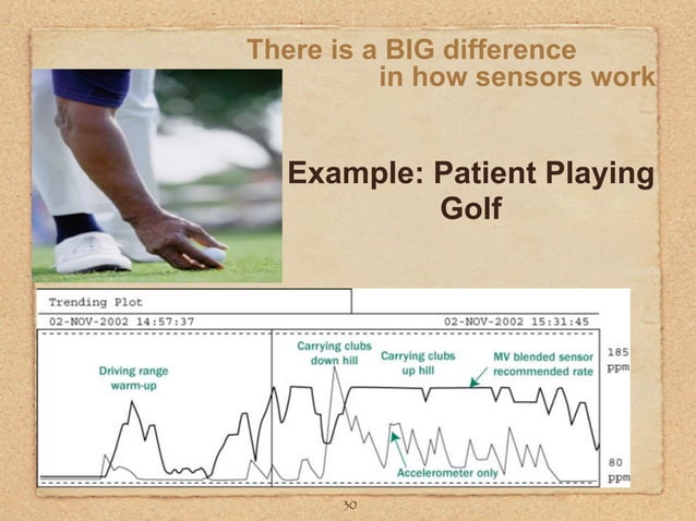 Chronotropic Incompetence | PPT