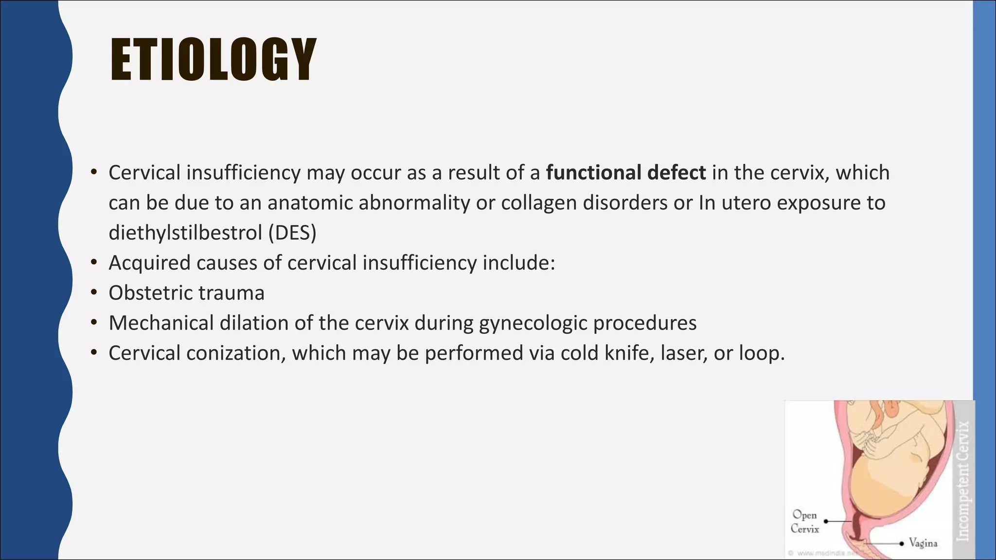 Cervical Incompetence (insufficiency) | PDF