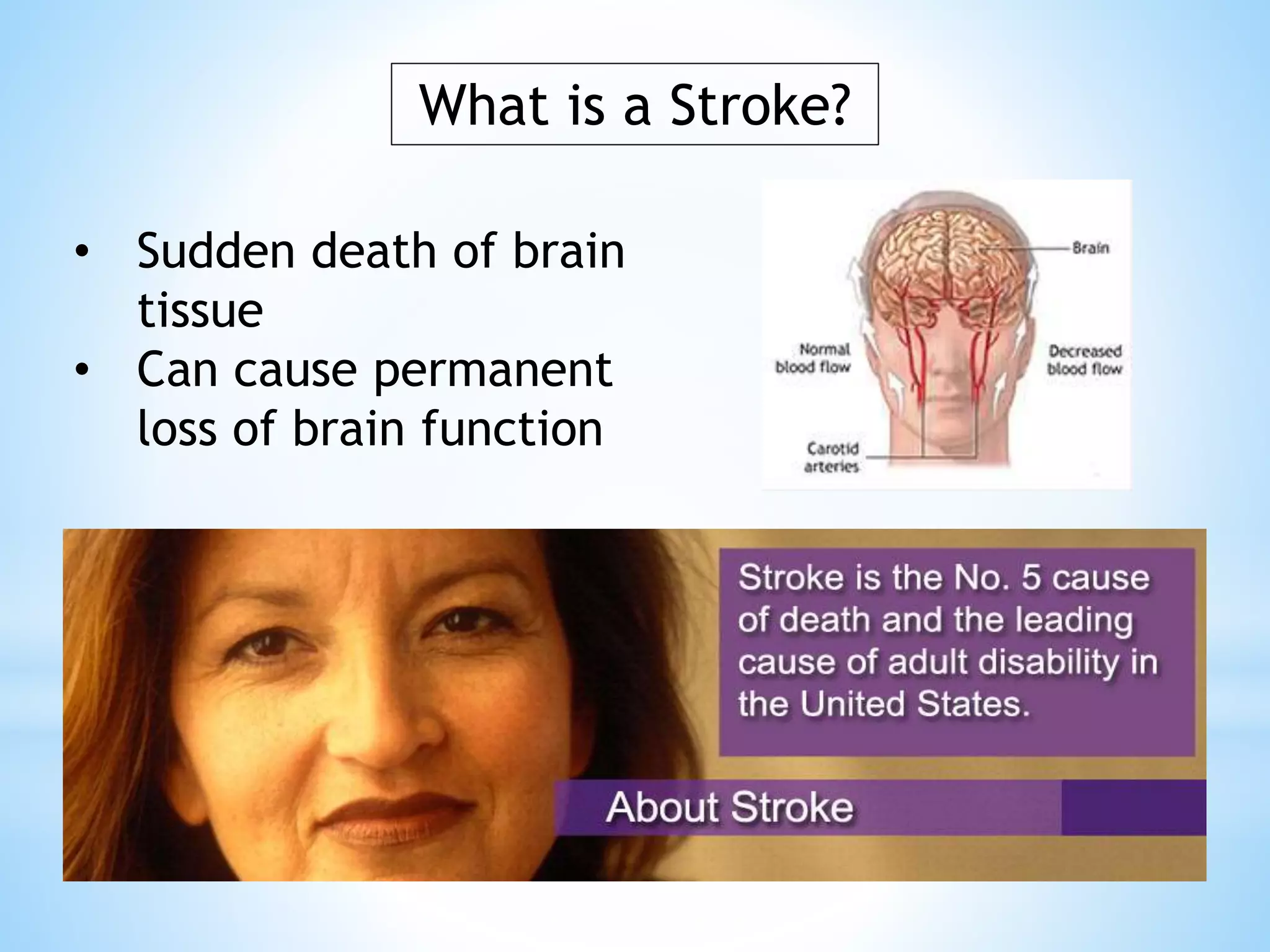Stroke Ppt