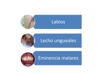 Cianosis | PPTX
