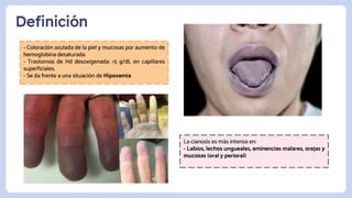 CIANOSIS.pptx