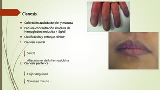 Cianosis e Ictericia.pptx