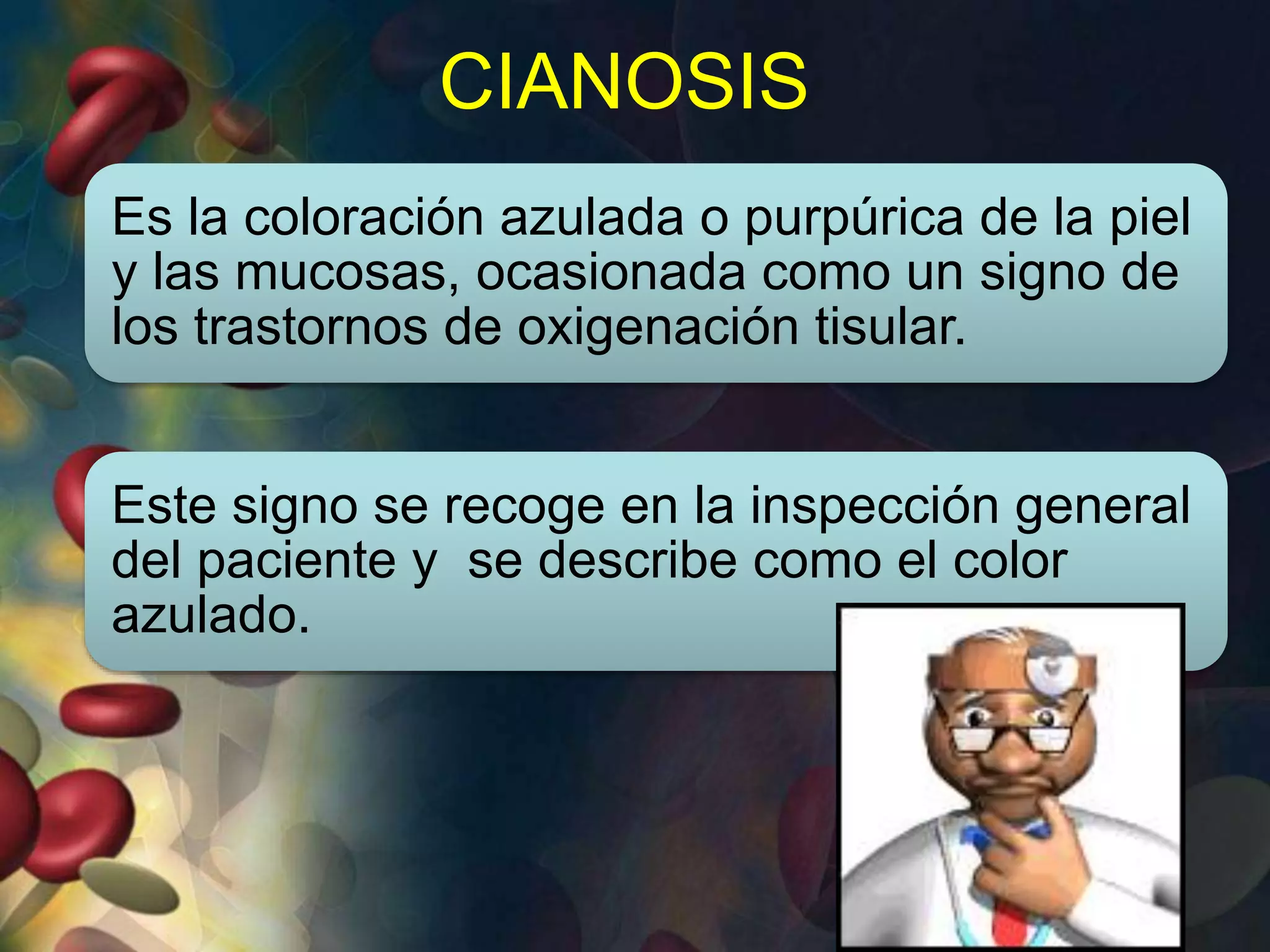 Cianosis Central y Periferica