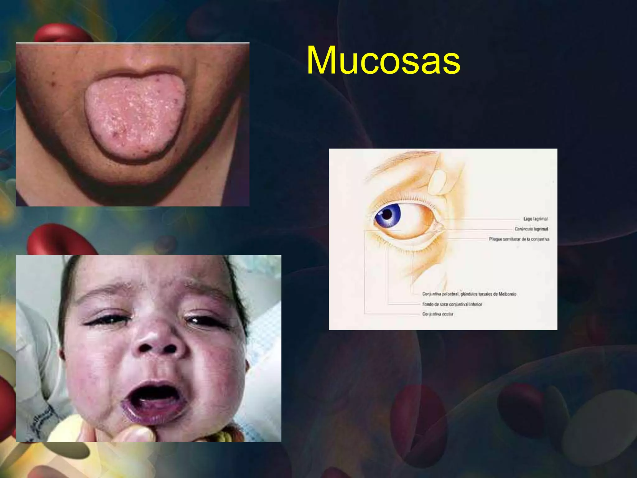 Cianosis Central y Periferica