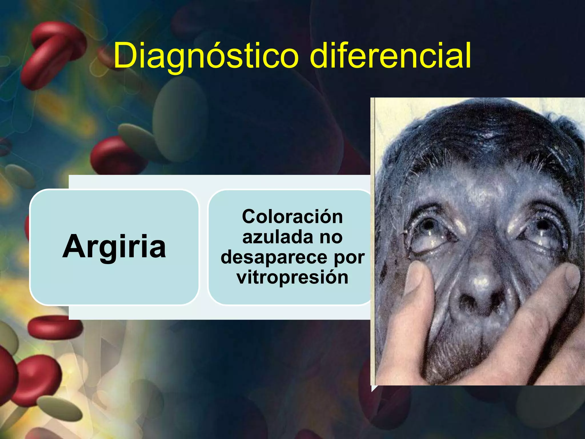 Cianosis Central y Periferica