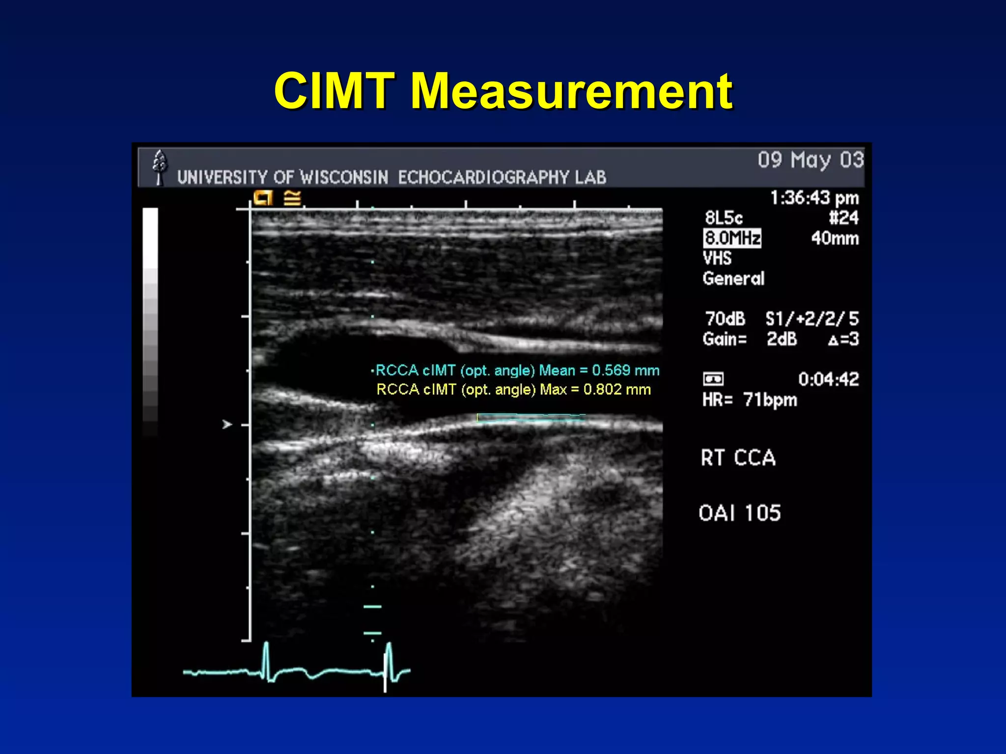 Stein cimt for shape 11-05 | PPT
