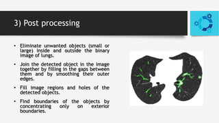 Lung nodule diagnosis from CT images based on ensemble learning | PPTX